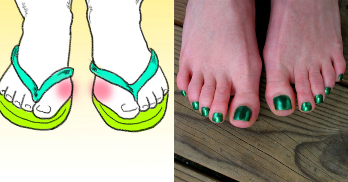 7 razones por las que nunca más deberías volver a usar chanclas