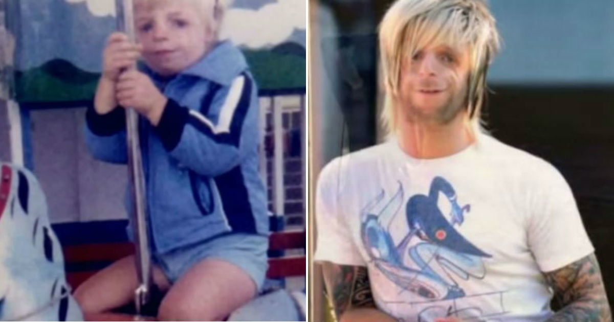 His Parents Abandoned Him Because Of How He Looks. Now He Moves ...