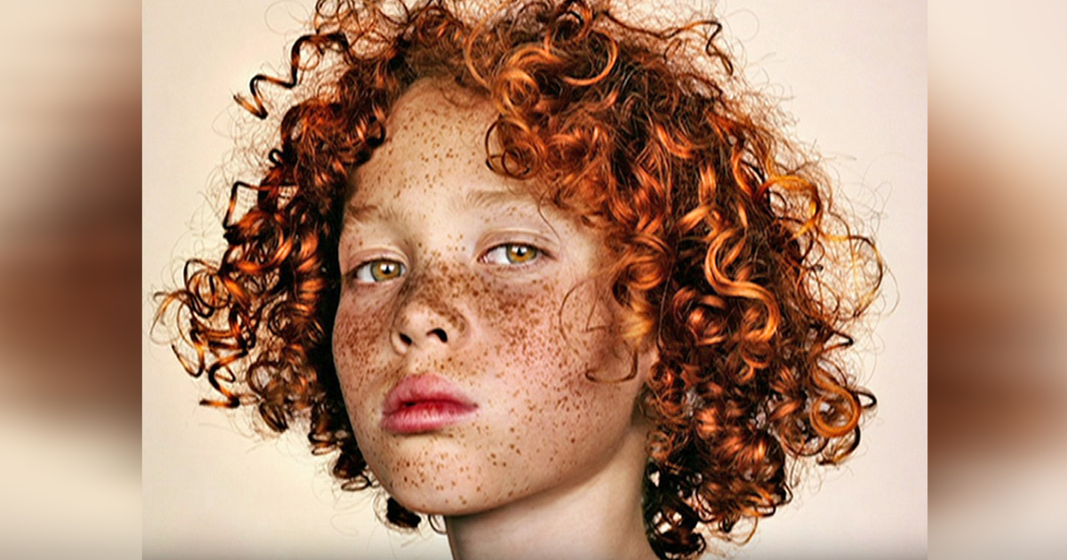 Photographer Creates A Stunning Tribute To The Beauty Of Freckles.