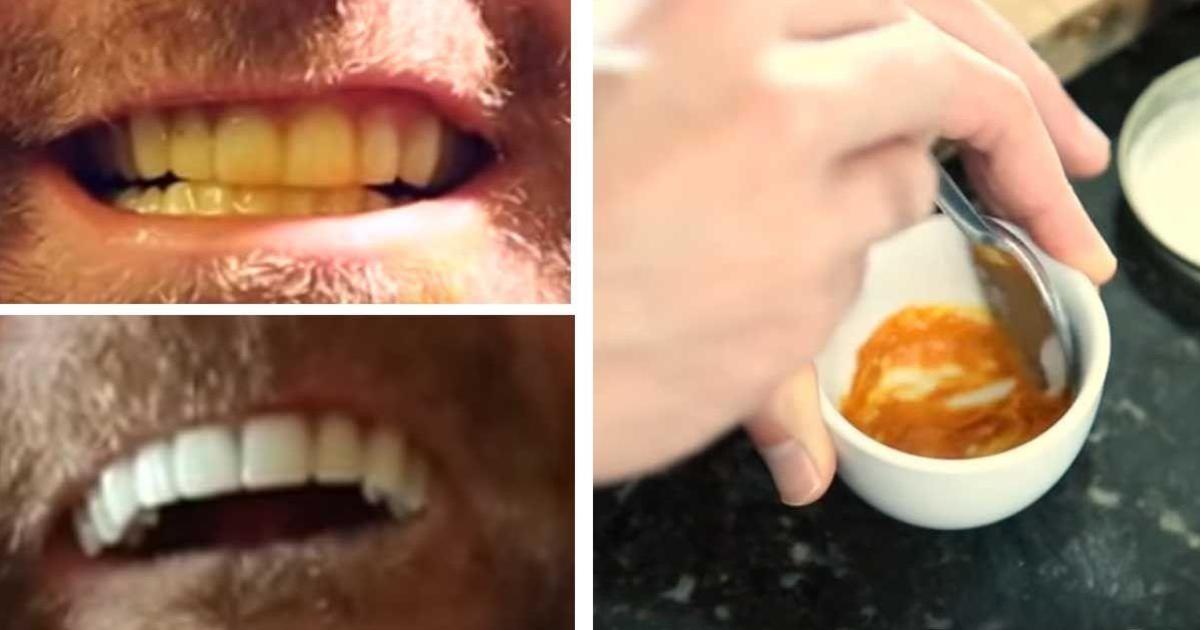 A ridiculously simple trick for whiter teeth that only uses 3 common ...