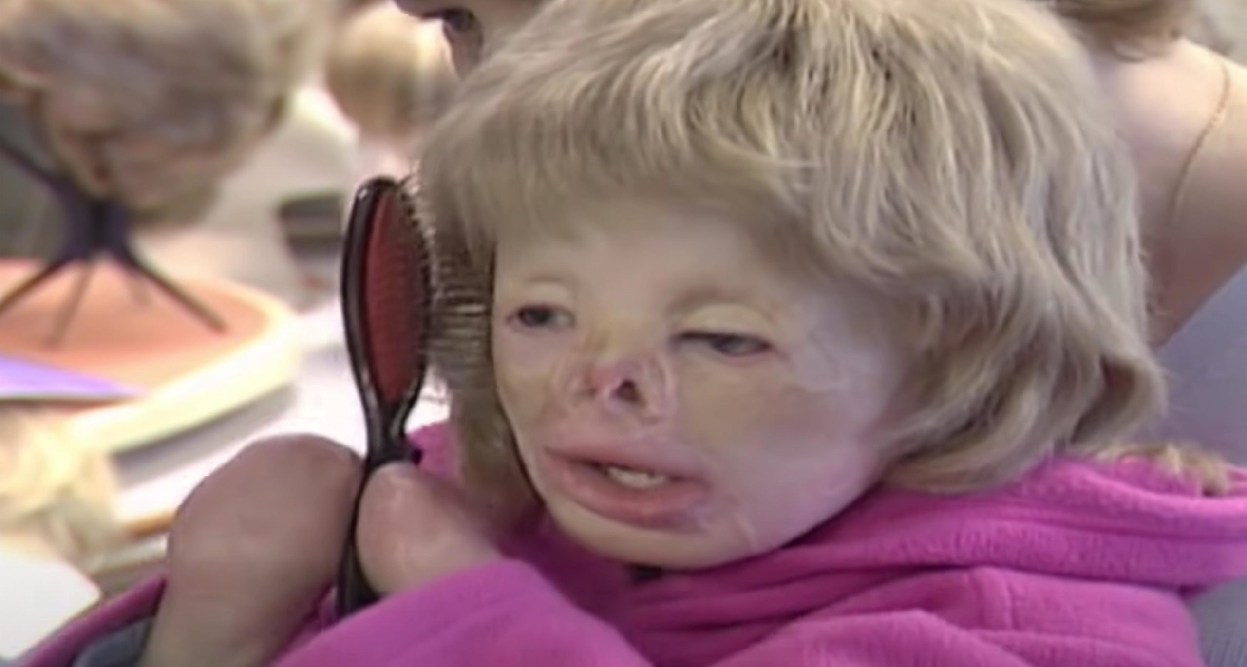 Terri Calvesbert survived house blaze against all odds – this is her today
