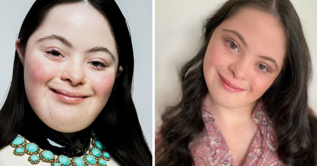 18-jähriges Model mit Down-Syndrom wird Star in Kampagne