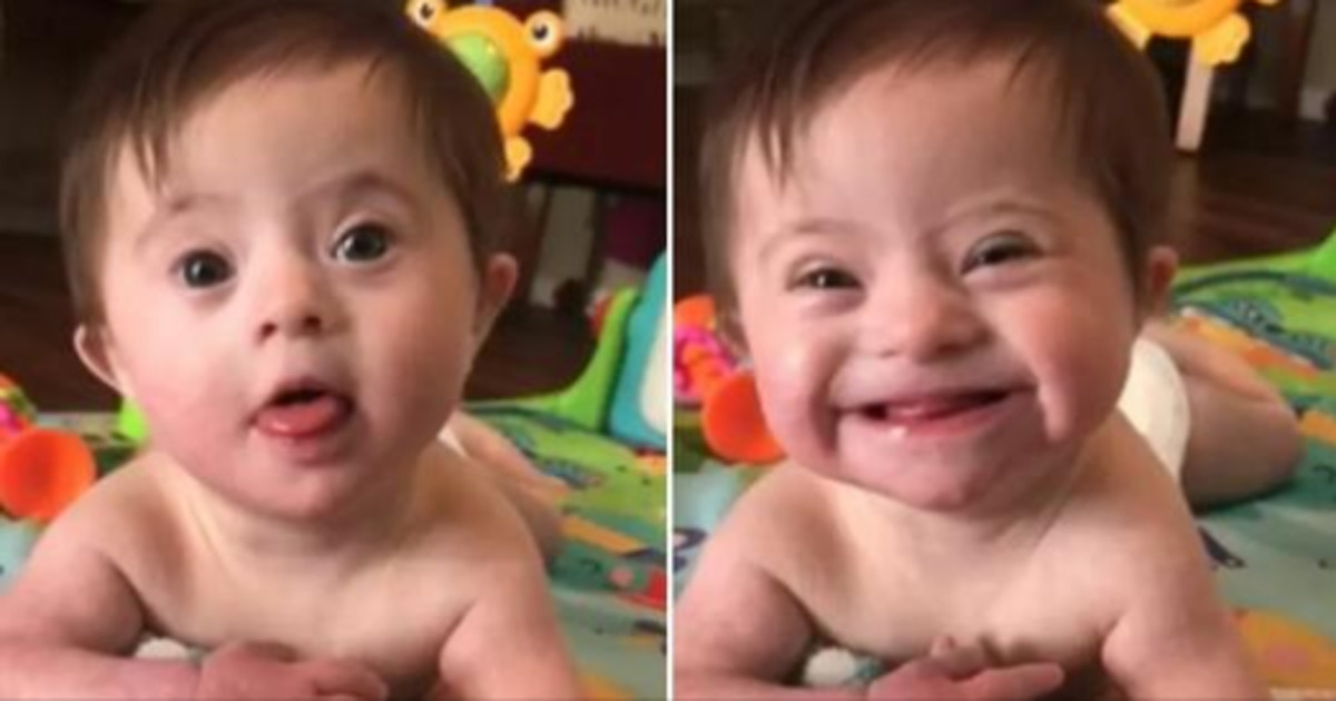 Vídeo de bebê adotada com Síndrome de Down sorrindo para sua nova mãe viraliza