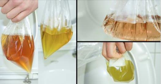 Voici ce que la couleur de votre urine révèle à propos de votre santé